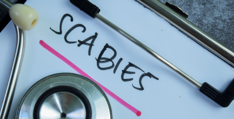 Scabia (raia): simptome, tratament si metode de preventie - Policlinica ...
