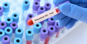 Totul despre potasiu - impactul sau asupra organismului | Blog