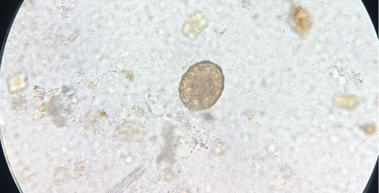 Recoltare probe materii fecale - analize scaun - Policlinica Analize ...