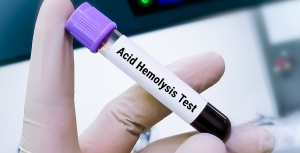 Hemoliza: simptome, cauze, tratament- Policlinica Analize Incredere | Blog