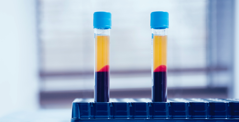 Trombocite crescute sau scazute: cauze, simptome, tratament ...